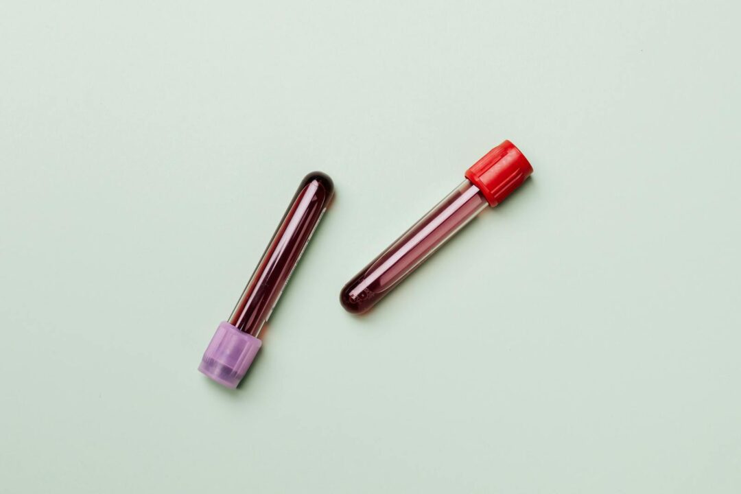 How your own blood can make you look younger! - The Harley Street Journal